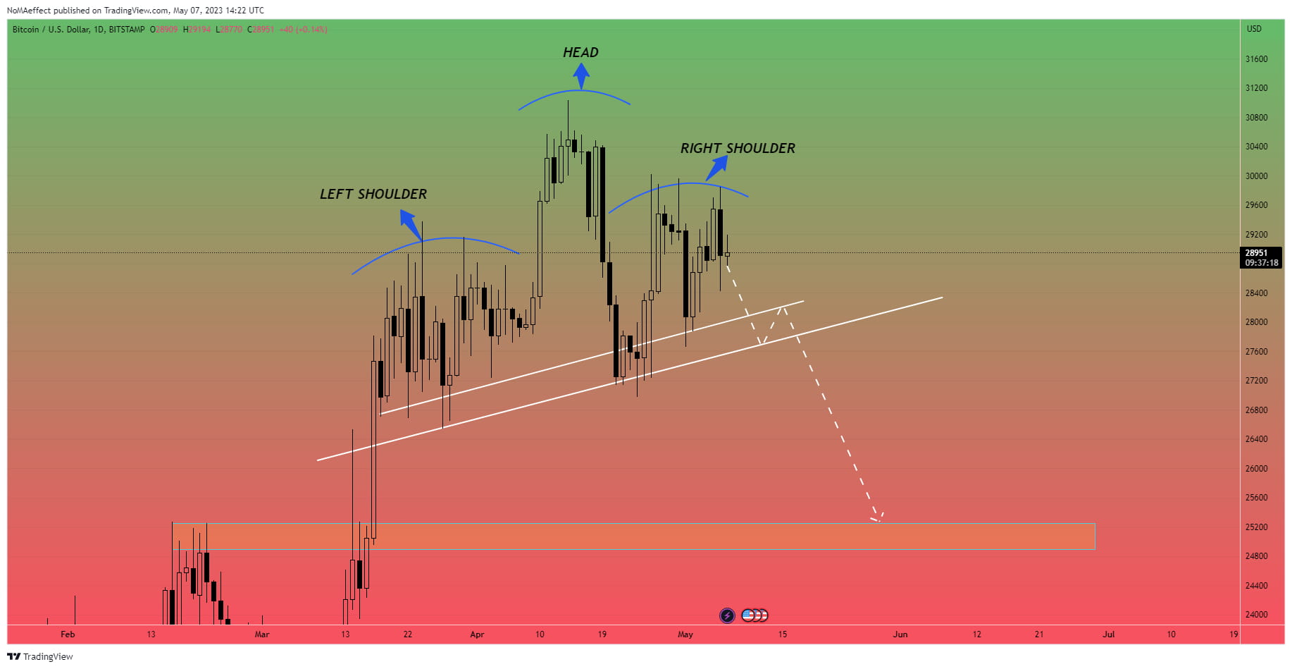 #BTC Formaning The Head And Shoulder Pattern On The 1D Tim | Crypto Dot Kid على Binance Square