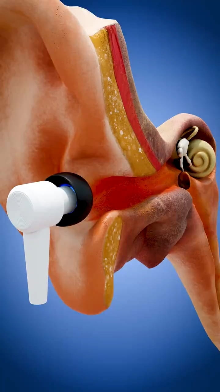 Did you know that high earphone volume can seriously damage your ears ...