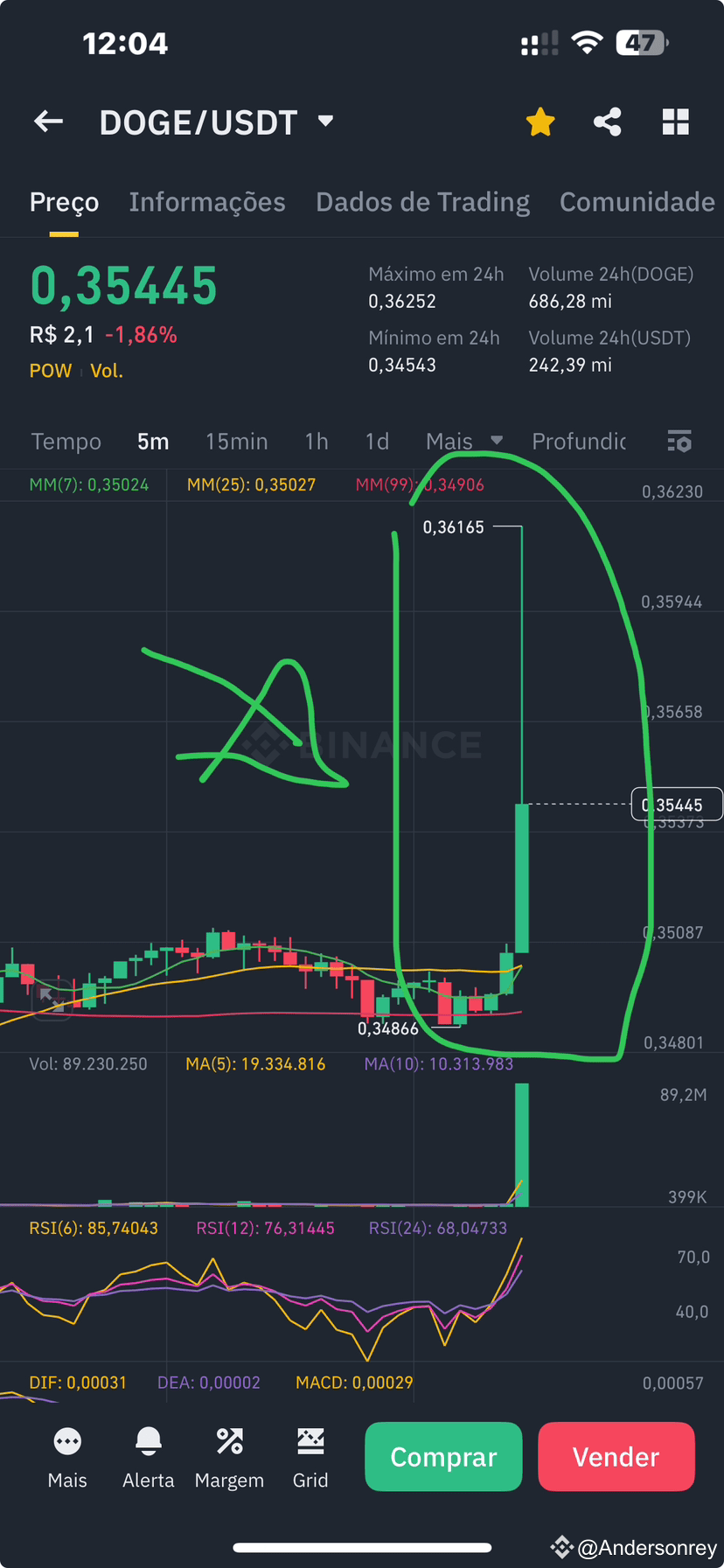 📊 ANALYSIS $DOGE - 12:04: An EXPLOSIVE BREAKOUT with UNIQUE ...