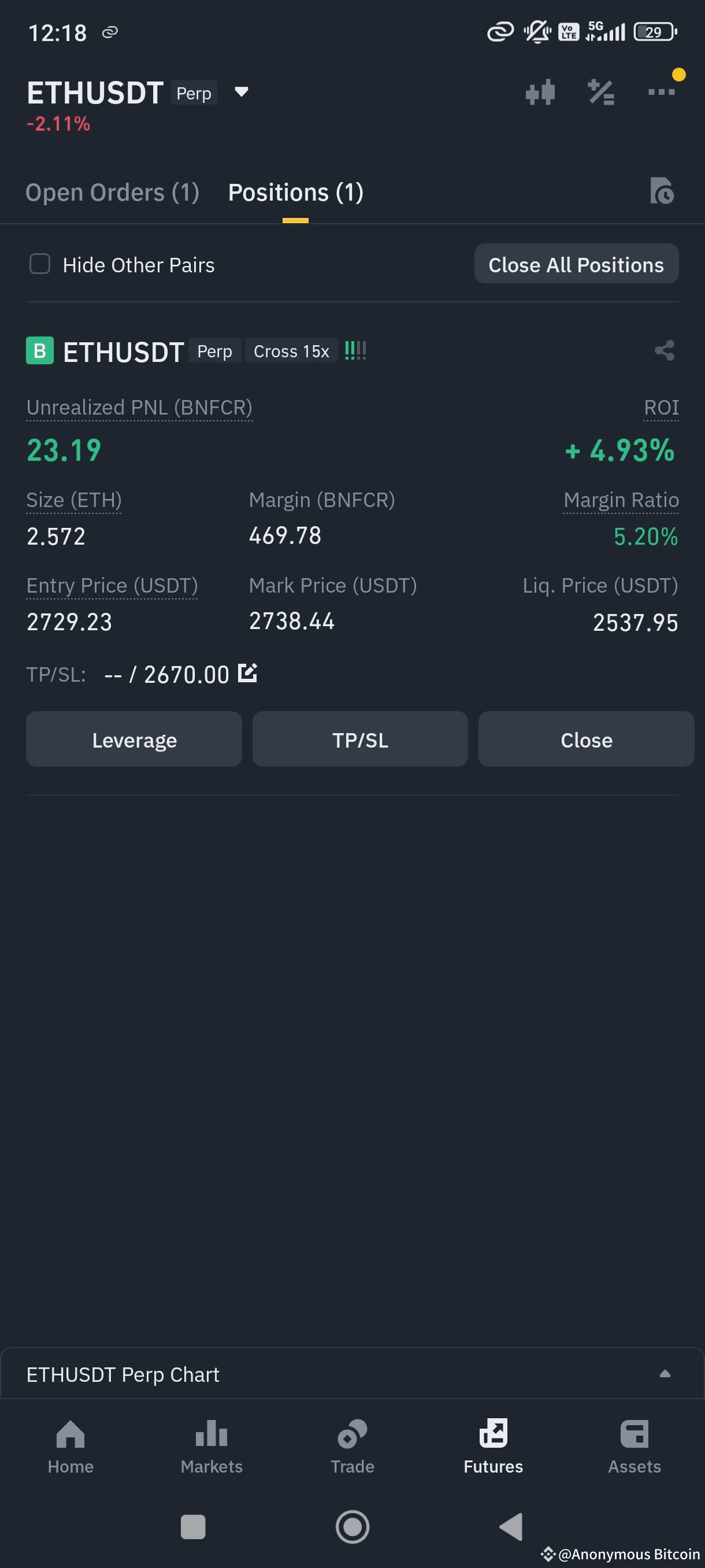 💥🔥 $ETH ETHEREUM EMERGENCY UPDATE🔥💥🔥💥🔥💥PLS read car | Anonymous Bitcoin on Binance Square